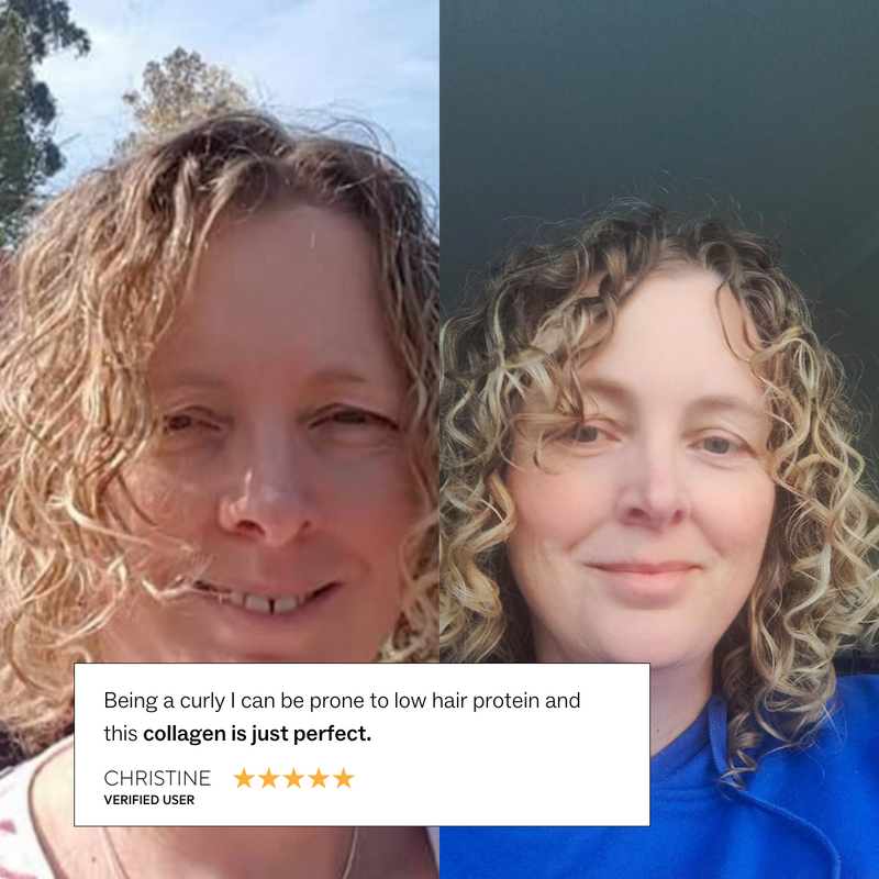 Collagen Restore™ | Australian | Benefits gut health in 7 days - My Way Up