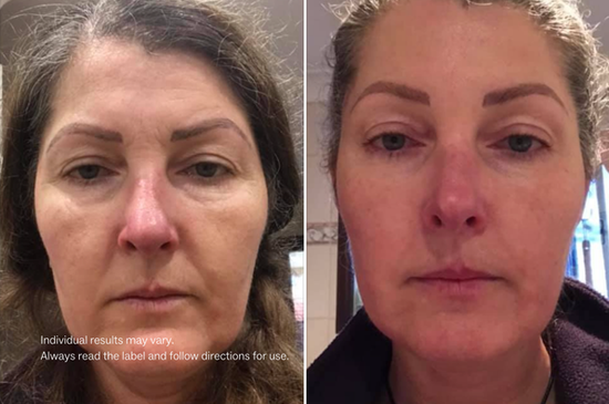 Collagen Restore™ | Advanced gut + beauty boost – My Way Up